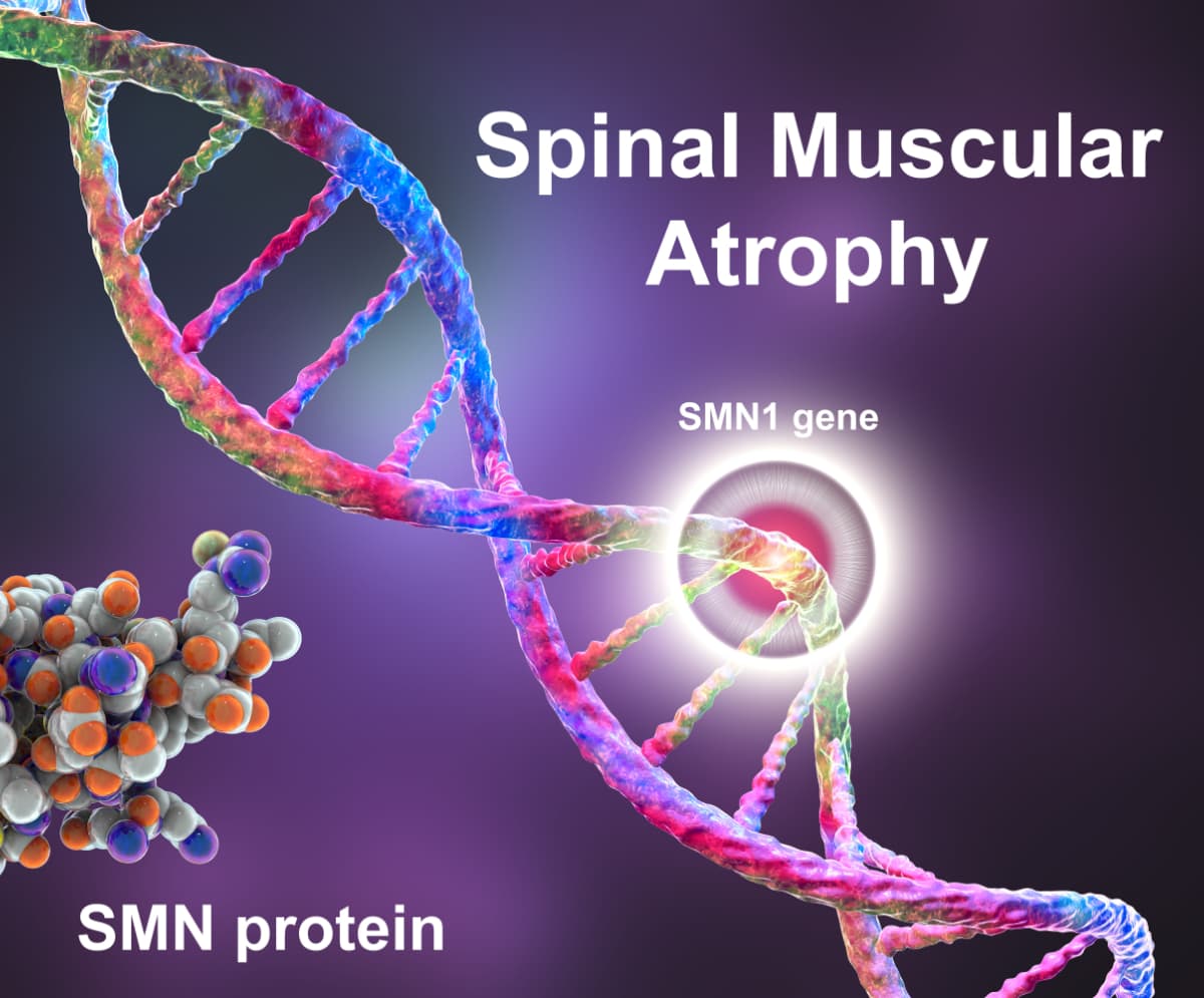 Feline Spinal Muscular Atrophy
